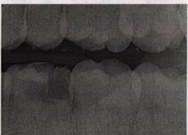 Why your SRP claims are denied and what you can do | Delta Dental