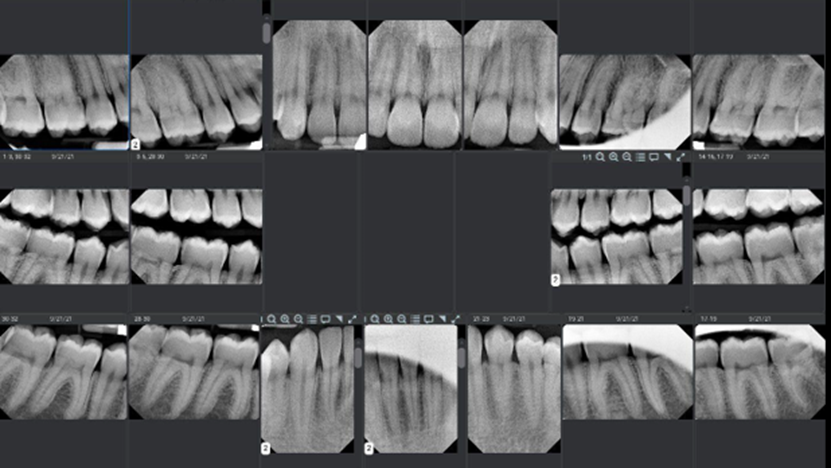 Why your SRP claims are denied and what you can do | Delta Dental