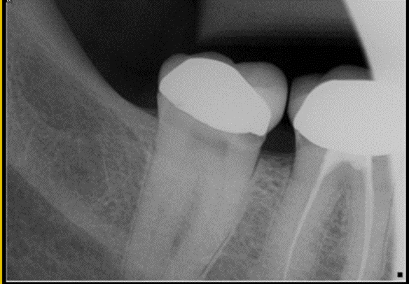 Dental X-Ray Claims Guidelines & Tips for Providers | Delta Dental